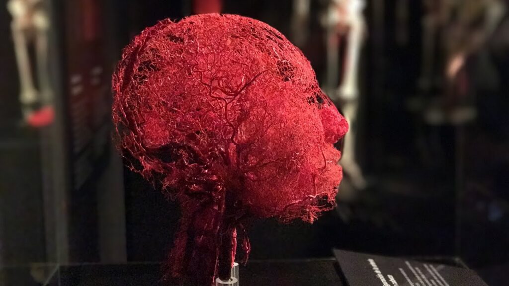 Gunther von Hagens's Plastinated Specimen of the Blood Vessels of the ...